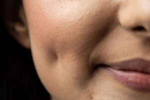 Cheek Piercing Guide: Pain, Healing, Risks & Aftercare