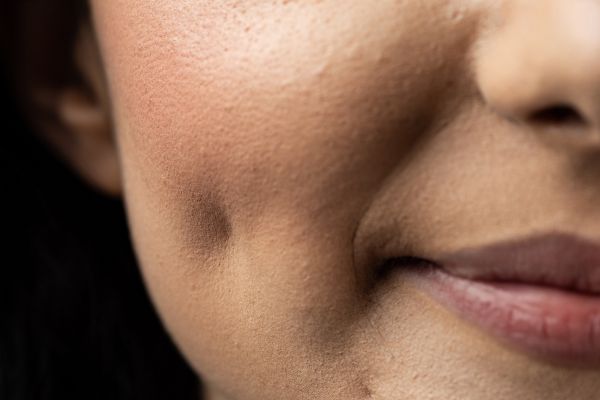 Cheek Piercing Guide: Pain, Healing, Risks & Aftercare