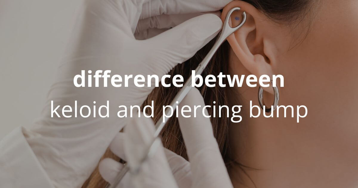 Keloid vs Piercing Bump: 9 Clear Signs to Tell the Difference Fast